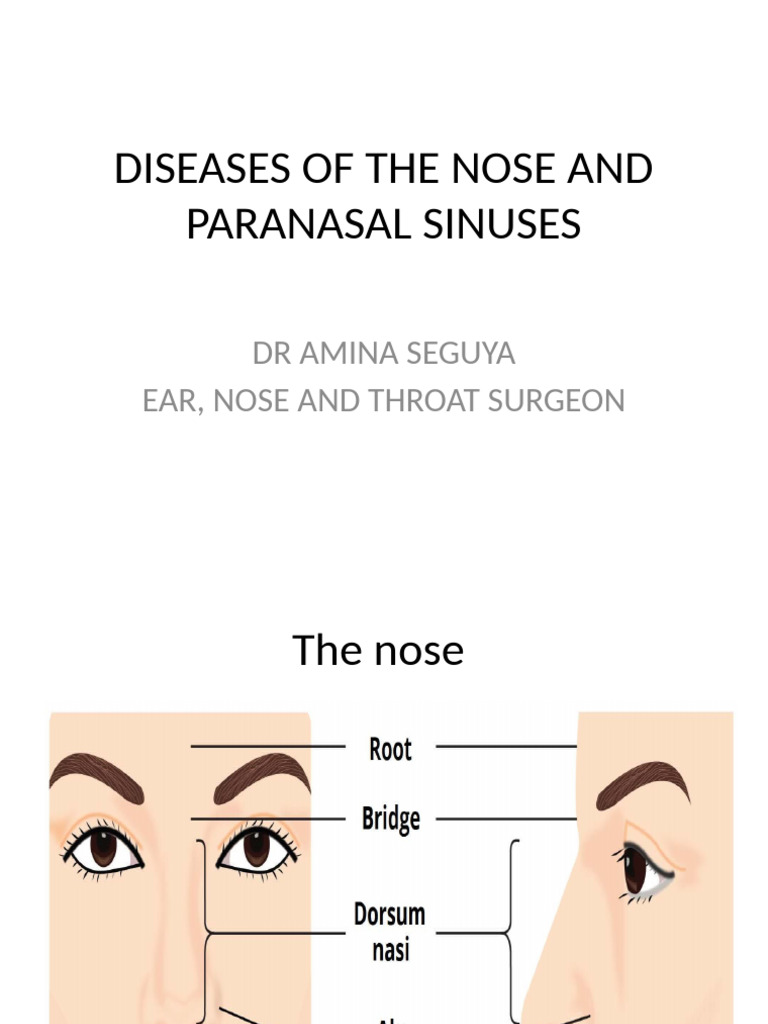 Diseases of The Nose and Paranasal Sinuses | PDF | Human Nose | Medical ...
