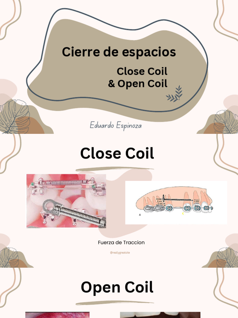 Tipos de Resortes en Ortodoncia | PDF | Hogar, jardinería y bricolaje ...