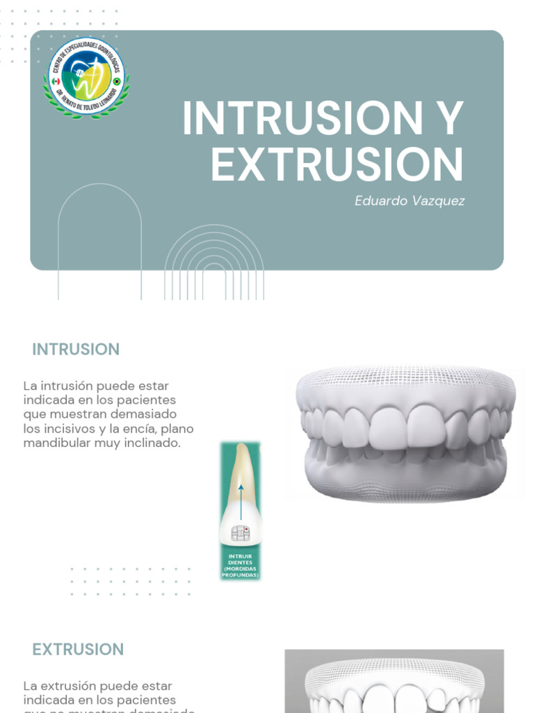 Intrusion y Extrusion | PDF