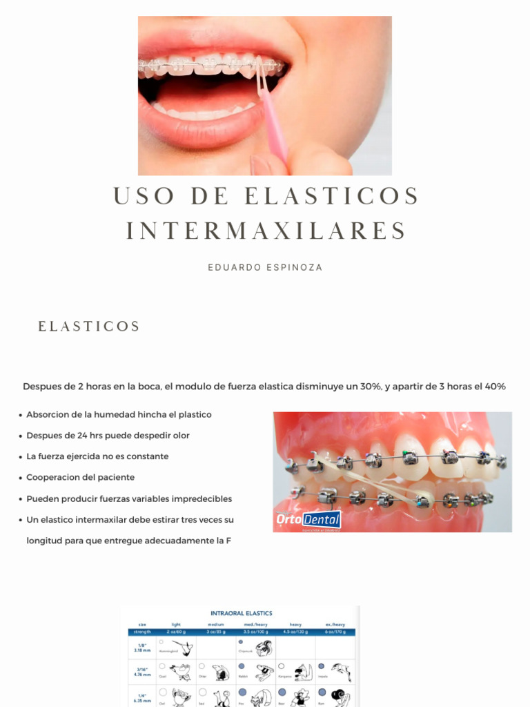Guía De Elásticos Intermaxilares Pdf