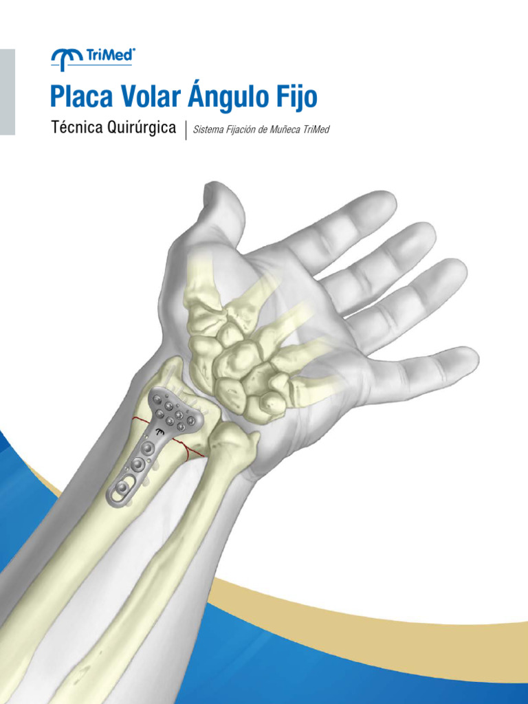 LC-72-2000-012 Rev-B - Es | PDF | Tornillo