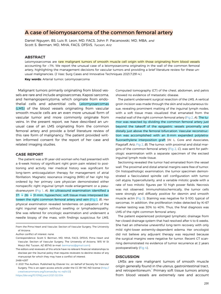 Acase of Leiomyosarcoma of The Common Femoral Artery | PDF | Cancer ...