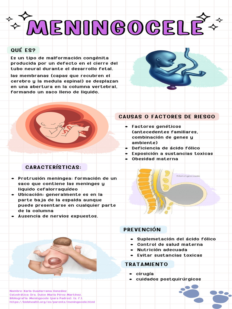 Meningocele: Causas y Prevención | PDF