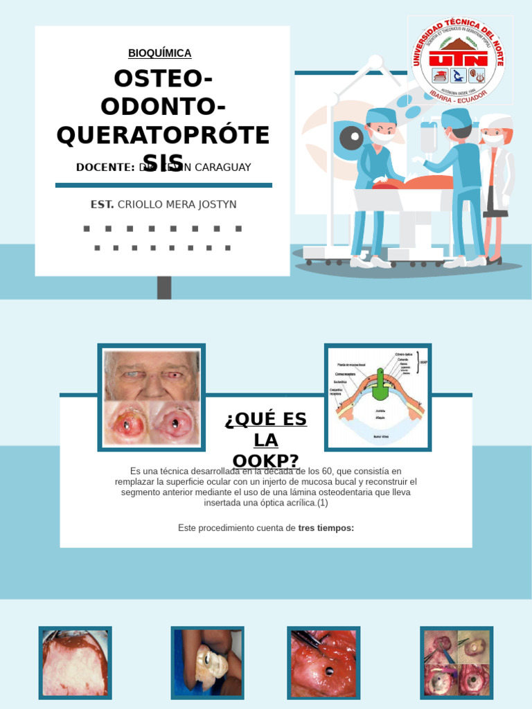 Osteo Odonto Queratoprótesis | PDF | Órganos sensoriales ...