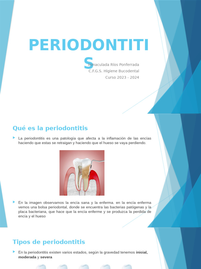 Guía Completa sobre Periodontitis | PDF | Enfermedades y trastornos ...