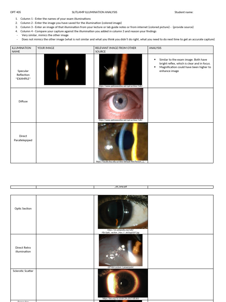 Slit Lamp Illuminations Self Evaluation | PDF | Radiation | Physical ...