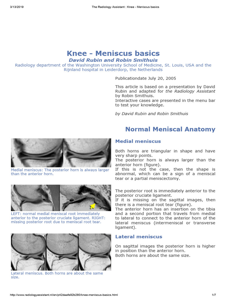 The Radiology Assistant - Knee - Meniscus Basics | PDF | Knee ...