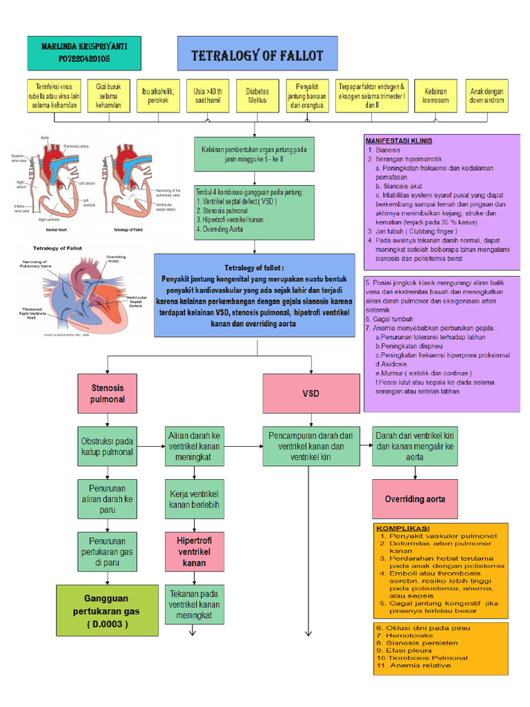 Marlinda Woc Tetralogy of Fallot | PDF