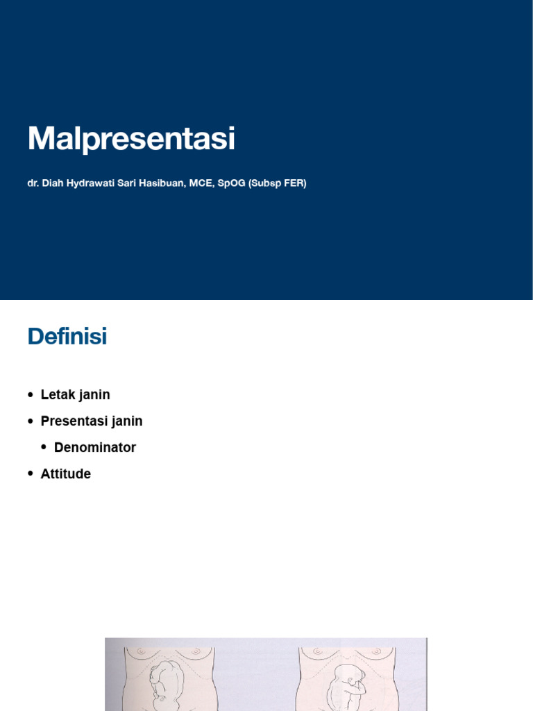 Malpresentasi - Kuliah 2024 | PDF | Sains & Matematika