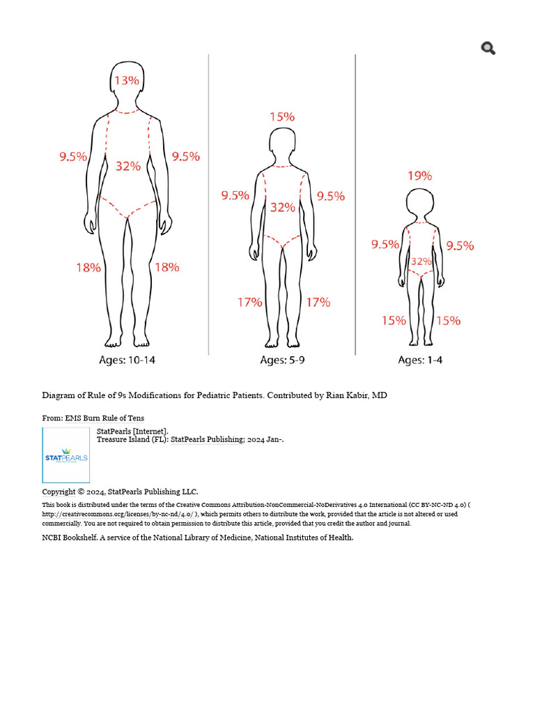 (Figure, Diagram of Rule of 9s Modifications For Pediatric Patients ...
