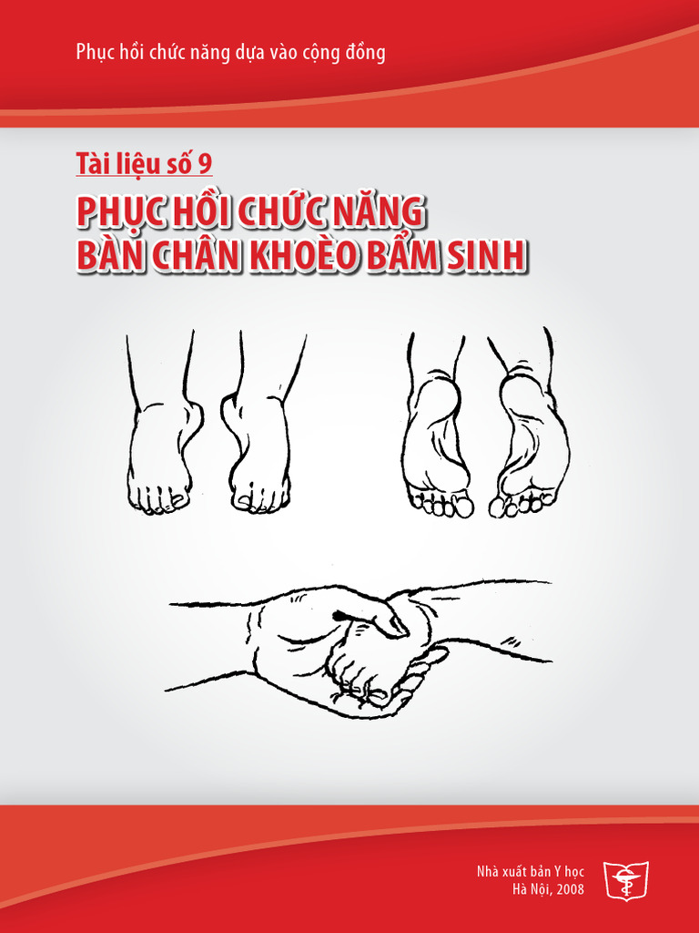 PHCN bàn chân khoèo bẩm sinh | PDF