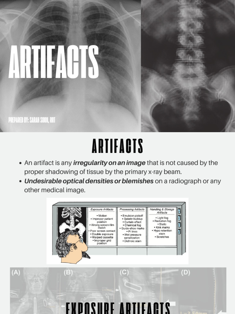Artifacts | PDF | Exposure (Photography) | Imaging