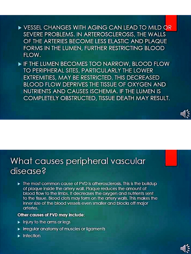 Peripheral Vascular Disease | PDF