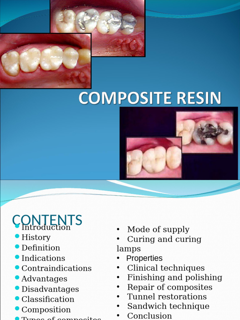 Comprehensive Guide to Dental Composites | PDF | Dental Composite ...