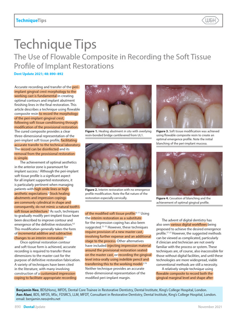 Flowable Composites | PDF | Dental Implant | Dentistry