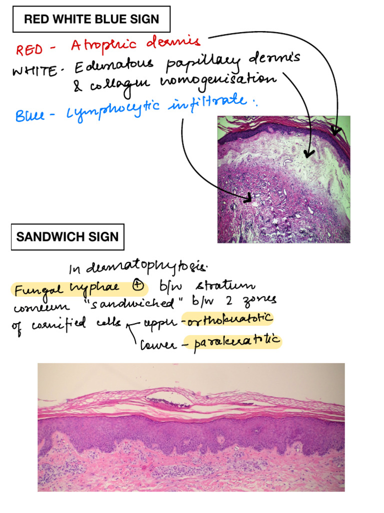 Red White Blue Sign | PDF