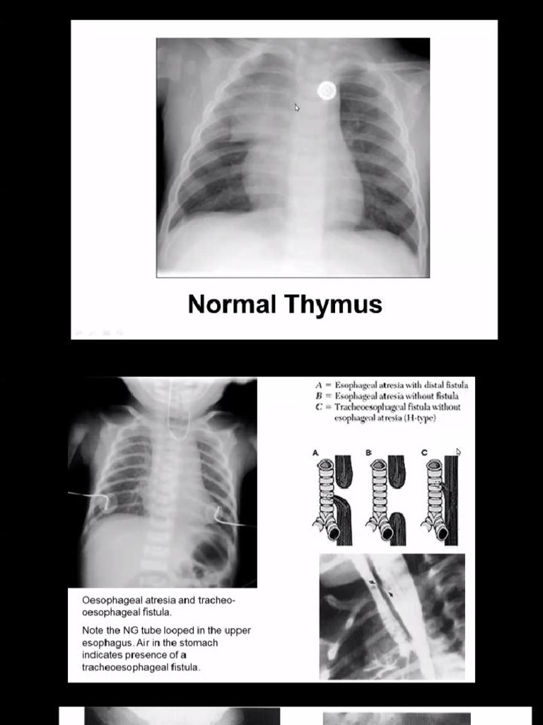 Osce X-Ray Online Peds | PDF
