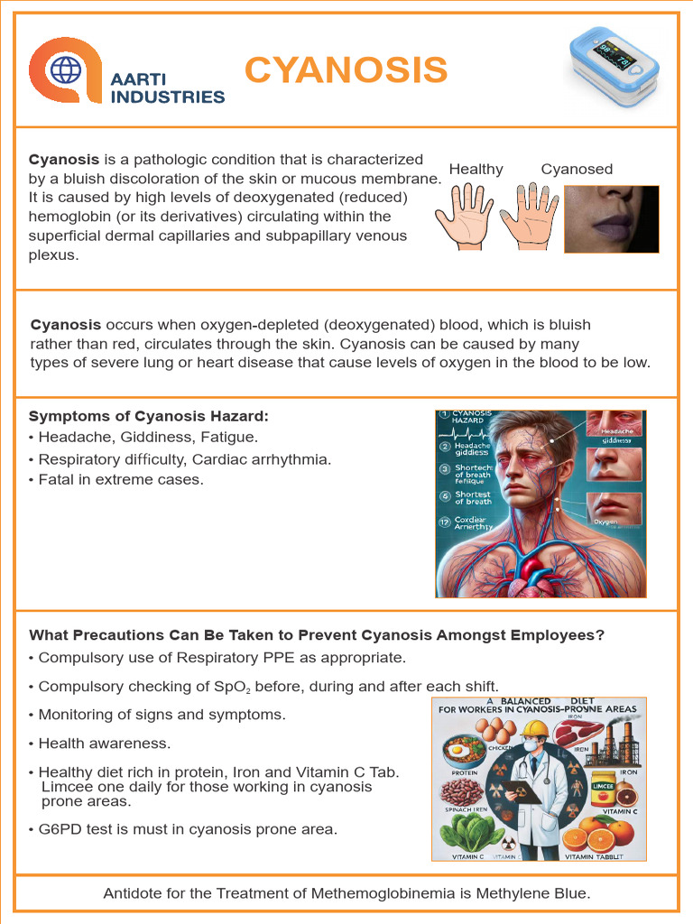 Cyanosis Prevention in the Workplace | PDF | Politics | Wellness