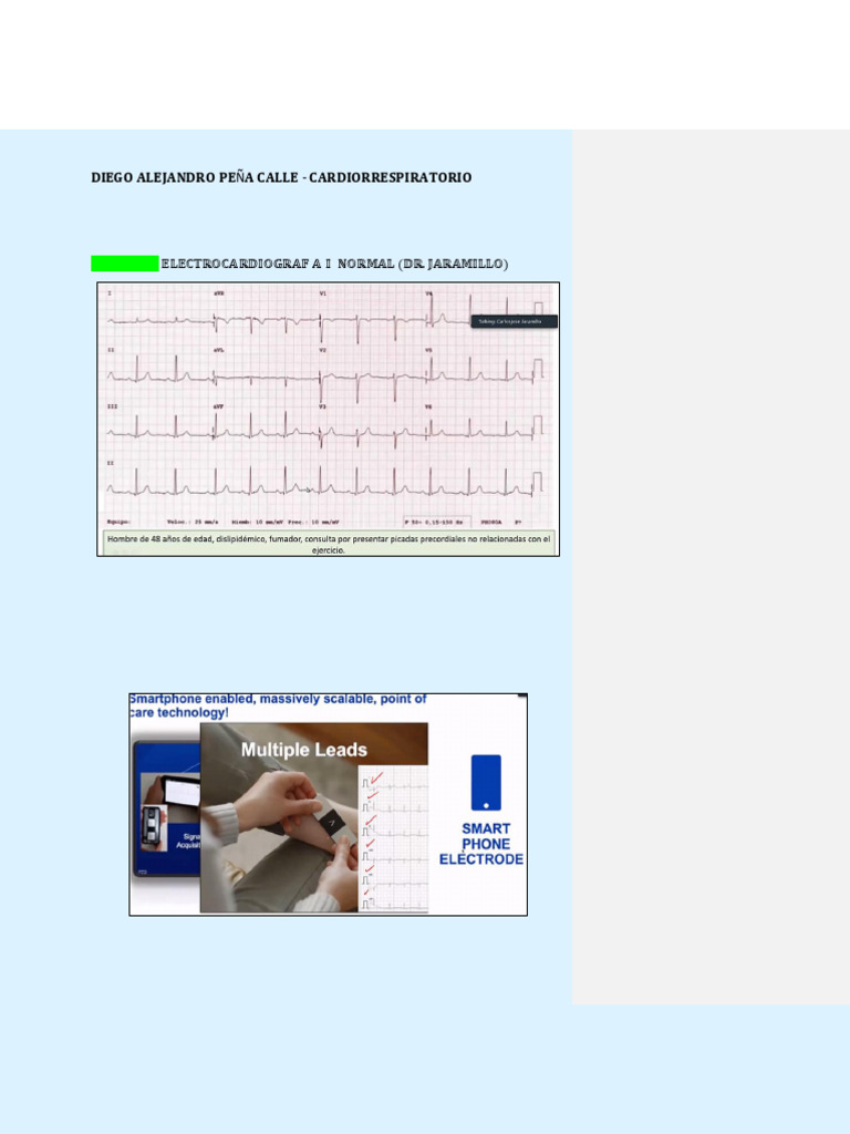 Interpretación del EKG: Guía Técnica | PDF | Electrocardiografia ...
