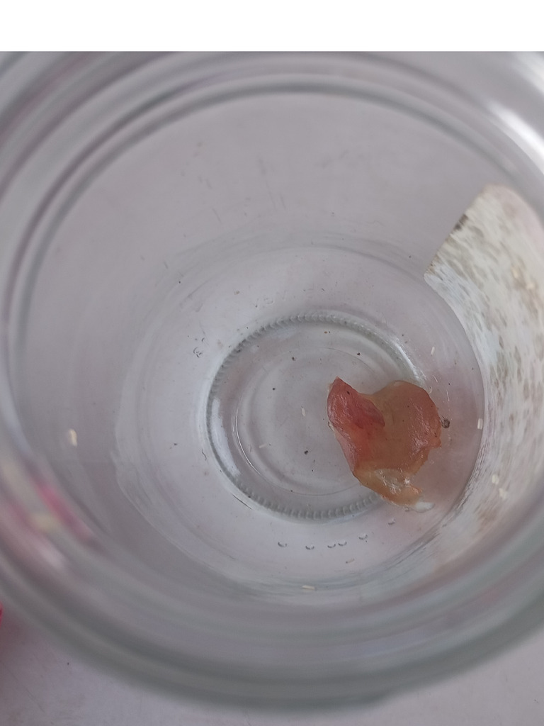 Teorías Del Caldo Primordial | PDF