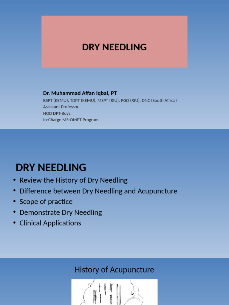 Lecture No. 10. Dry Needling - B | PDF | Elbow | Arm