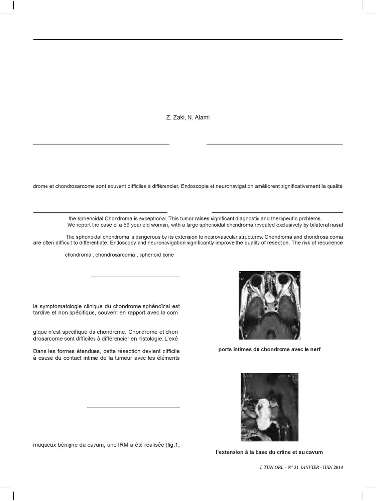 Chondrome sphénoïdal : cas clinique et suivi | PDF | Imagerie par ...
