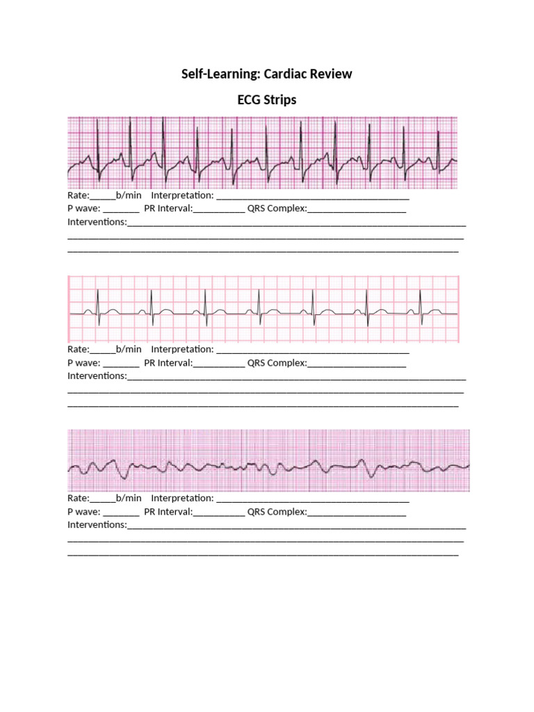 ECG Strips KPJAN2022 | PDF | Electrocardiography | Cardiology