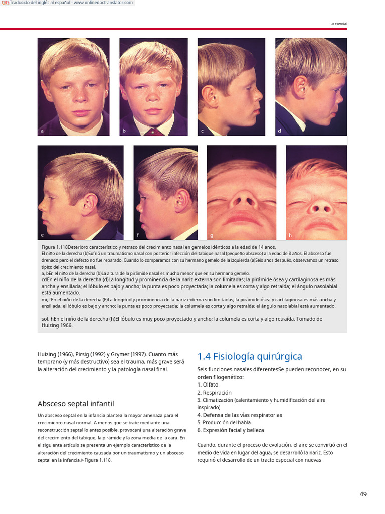 Egbert H Huizing Johan a M de Groot Functional Reconstructive Nasal-63 ...
