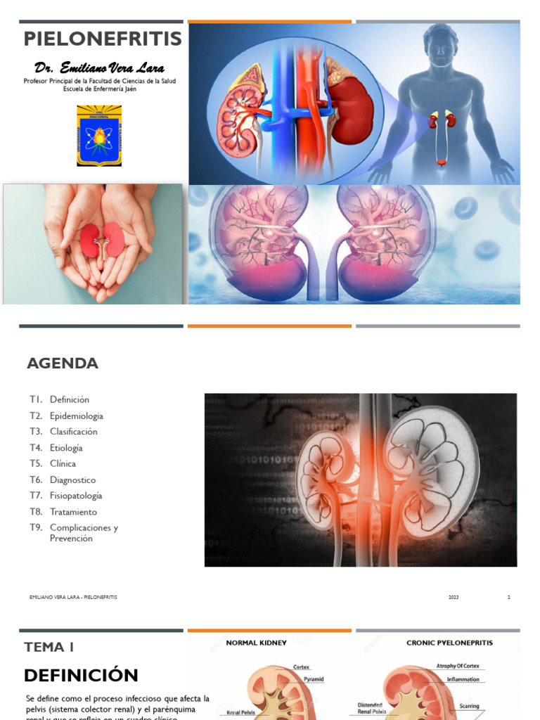 Pielonefritis | PDF | Infección del tracto urinario | Especialidades ...