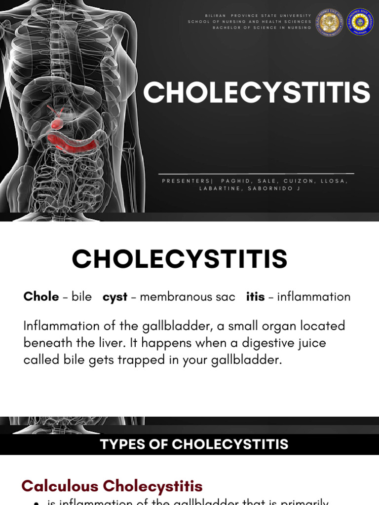 Cholecystitis | PDF | Science & Mathematics