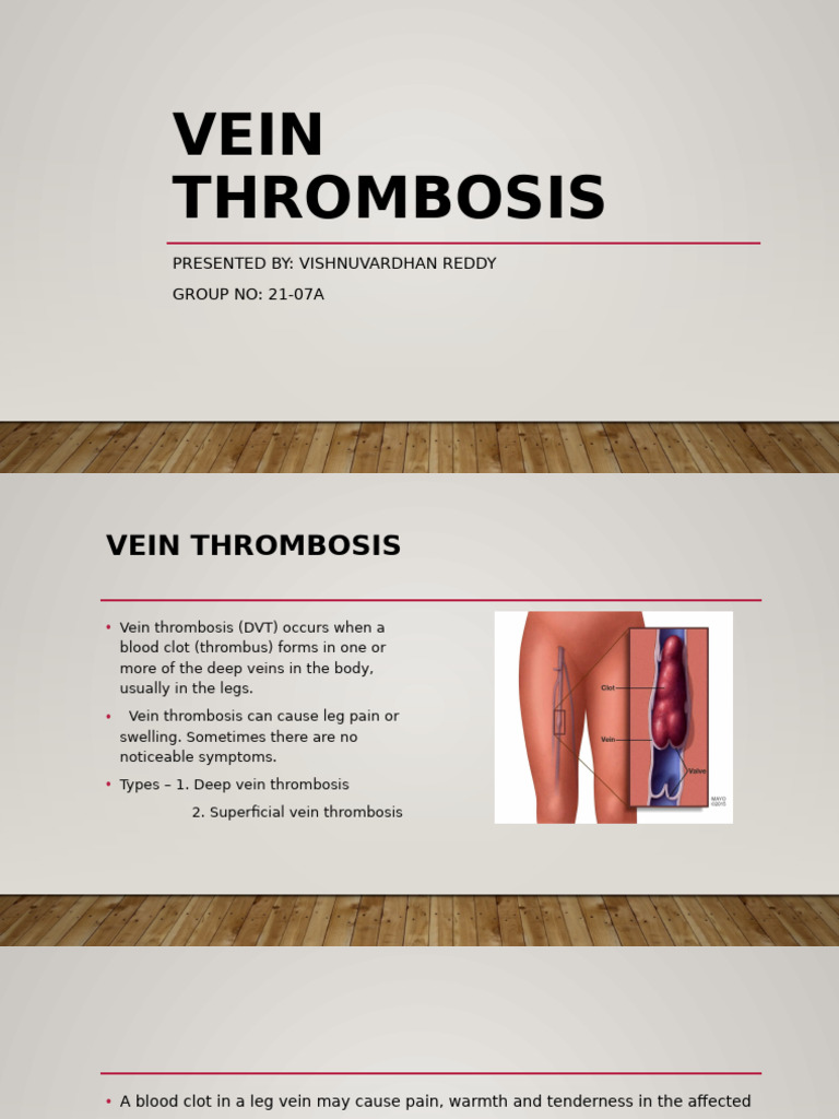 Vein Thrombosis | PDF