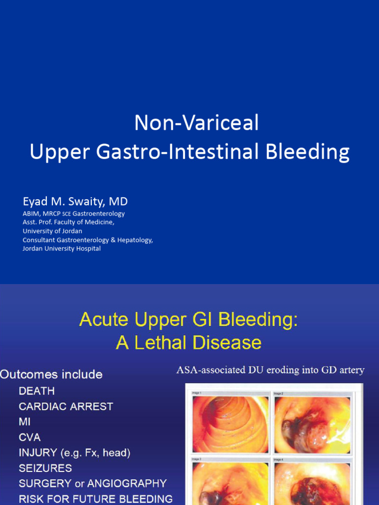UGIB | PDF | Stomach | Medical Specialties