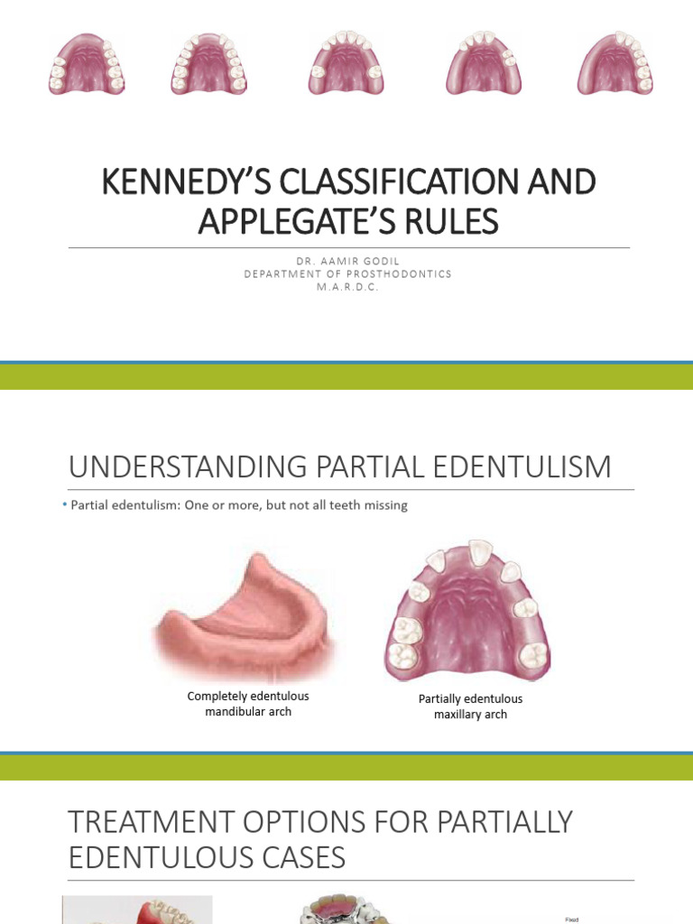 Kennedy’s Classification Bds-II | PDF | Dentures | Dentistry Branches