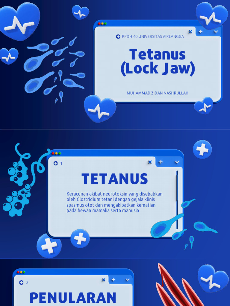 Tetanus | PDF