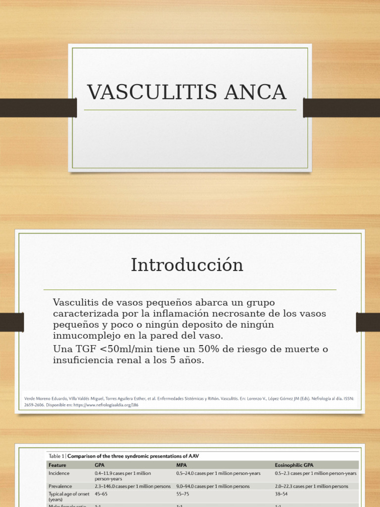 Vasculitis Anca | PDF