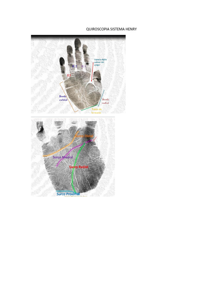 Quiroscopia 11 | PDF