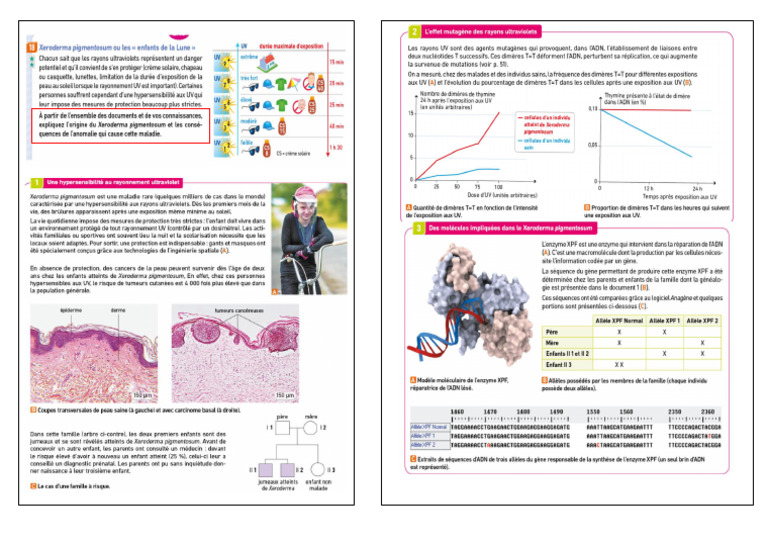 SVT Exo Xeroderma Bordas | PDF