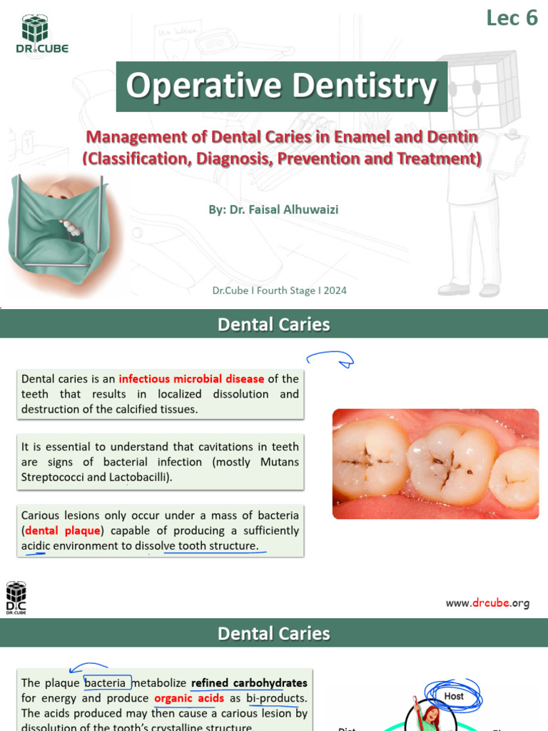 Operative4 Lec 6 Management of Dental Caries in Enamel and Dentin | PDF | Human Tooth | Tooth Enamel