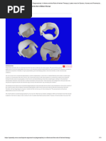 Argenta Classification of Plagiocephaly | PDF | Childhood | Medical ...