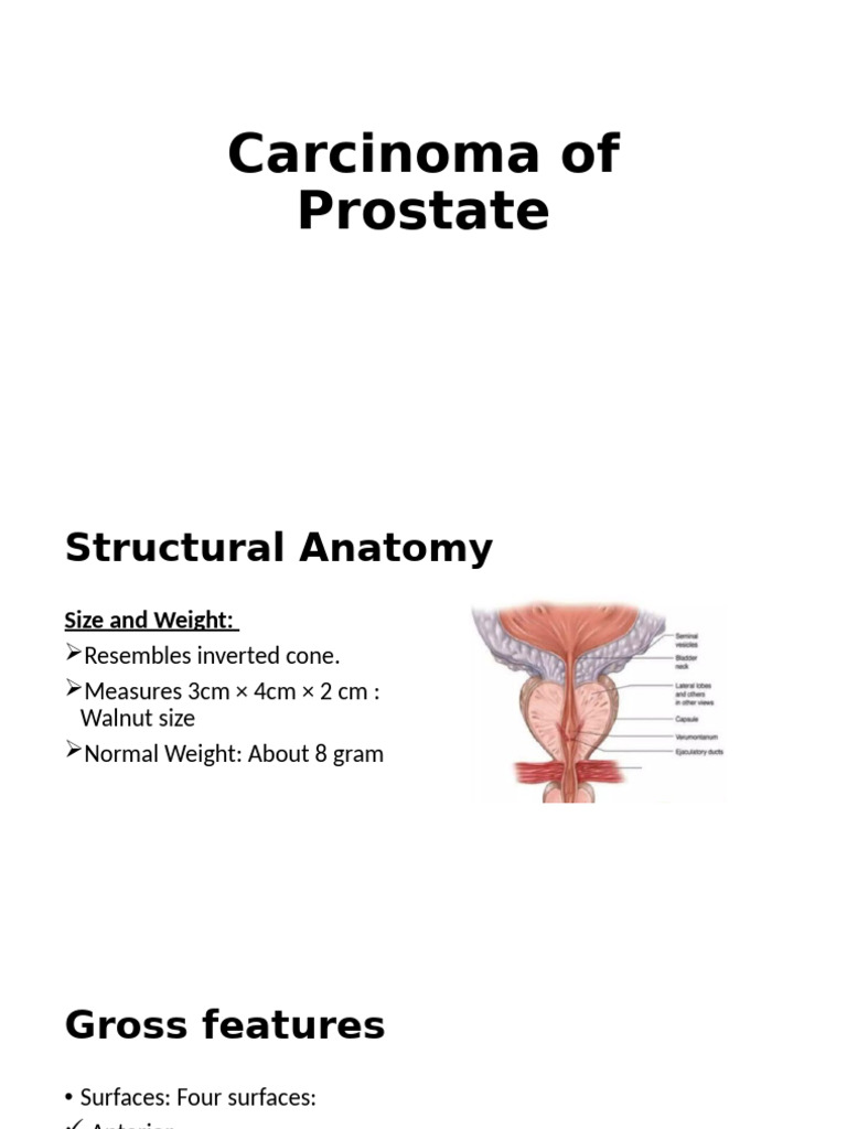 Carcinoma of Prostate | PDF | Prostate Specific Antigen | Prostate Cancer