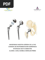 Reconstrucción ACL con Endobutton 15mm | PDF | Extremidades (anatomía ...