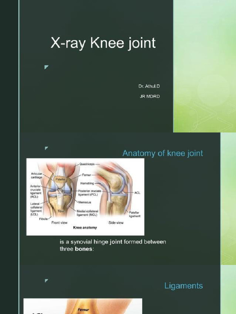 X Ray Knee Joint | PDF
