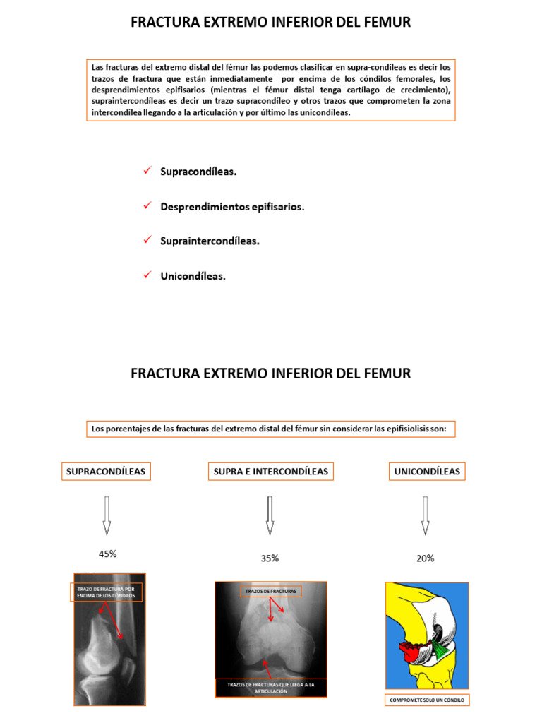 11 Fractura Extremo Distal Femur | PDF | Lesión | Anatomía humana