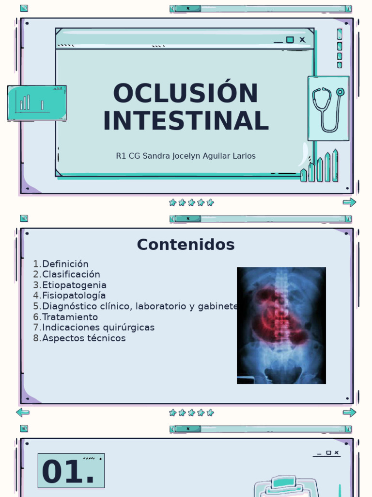 Oclusión Intestinal | PDF | Tracto gastrointestinal | Medicina