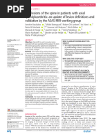 ASDAS Calculator for Ankylosing Spondylitis | PDF | Back Pain ...