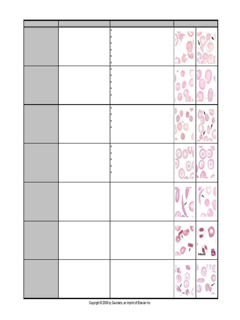 Heme Review Tables From Text | PDF | Anemia | Leukemia