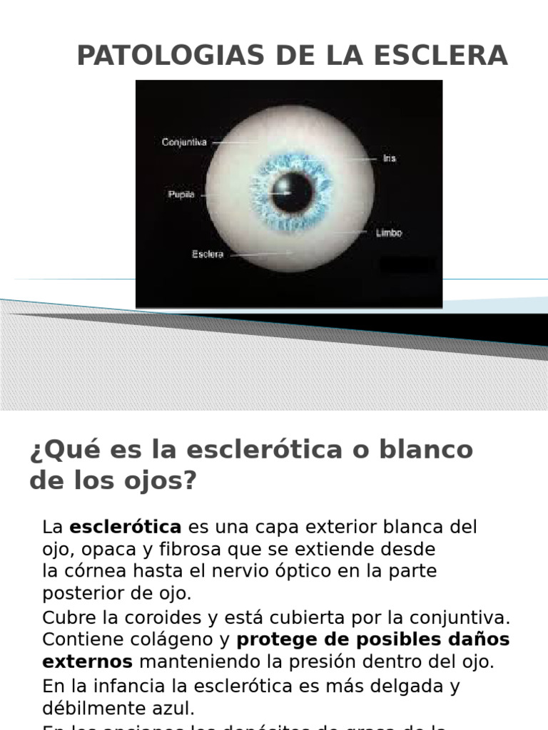 Patologias de La Esclera | PDF | Ojo humano | Especialidades Medicas