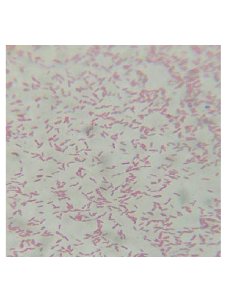 Colonies of Anaerobic Bacteria Under Light Microscope Compressed | PDF