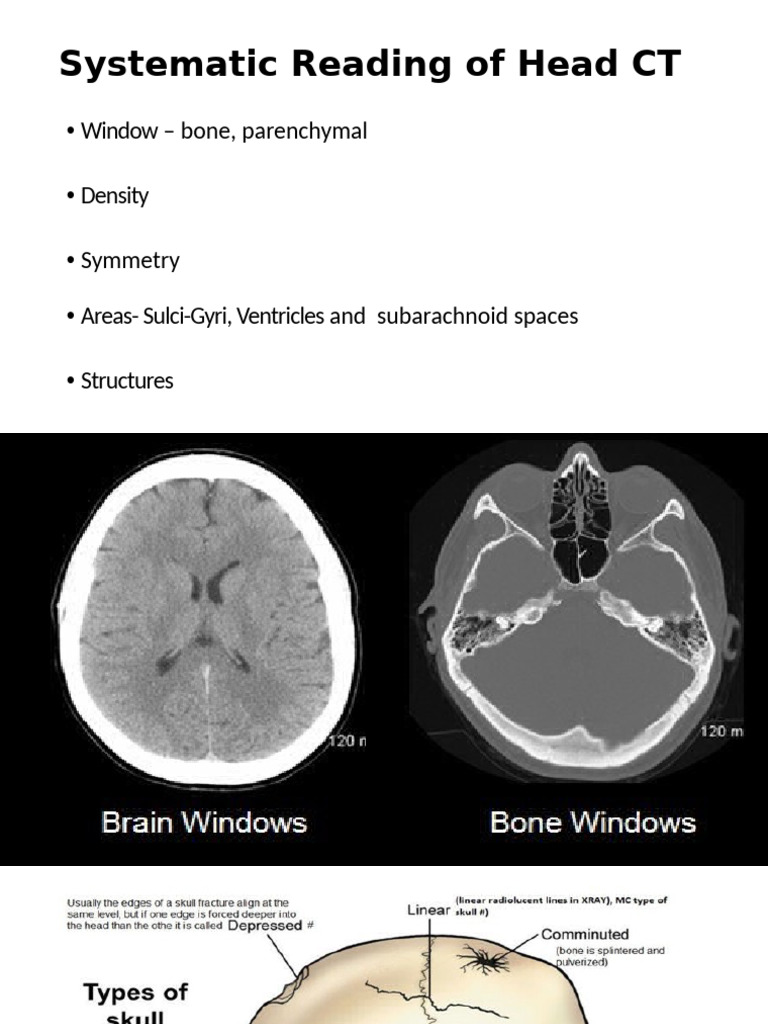 Neurosurgery CT | PDF