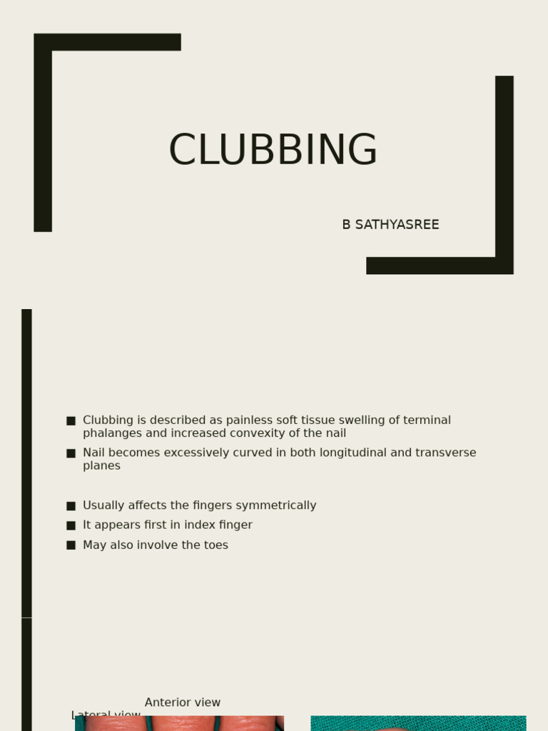 Grading and Causes of Finger Clubbing | PDF | Nail (Anatomy) | Finger